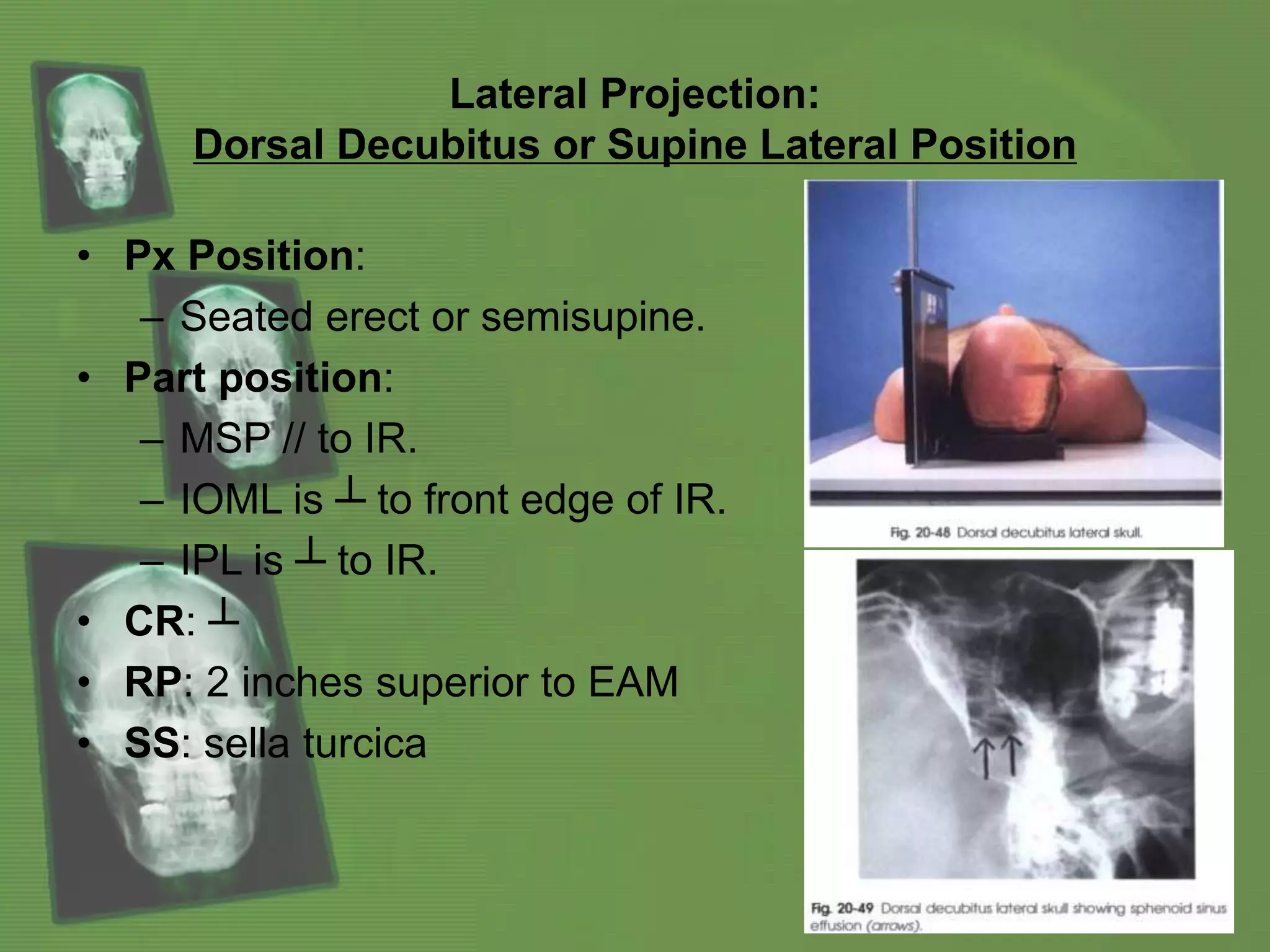 SKULL: Radiologic Positioning (Non-contrast) | PPTX
