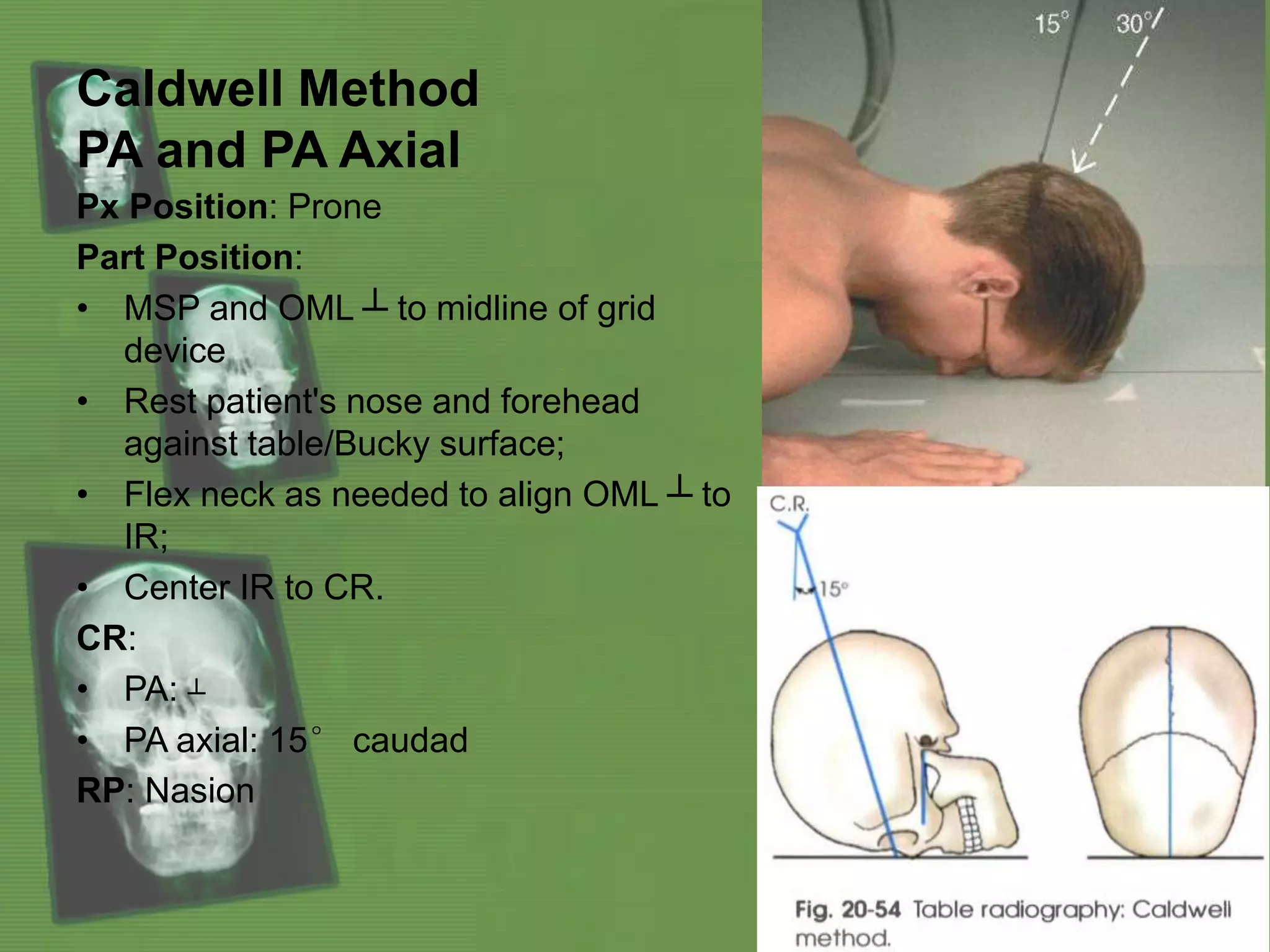 SKULL: Radiologic Positioning (Non-contrast) | PPTX