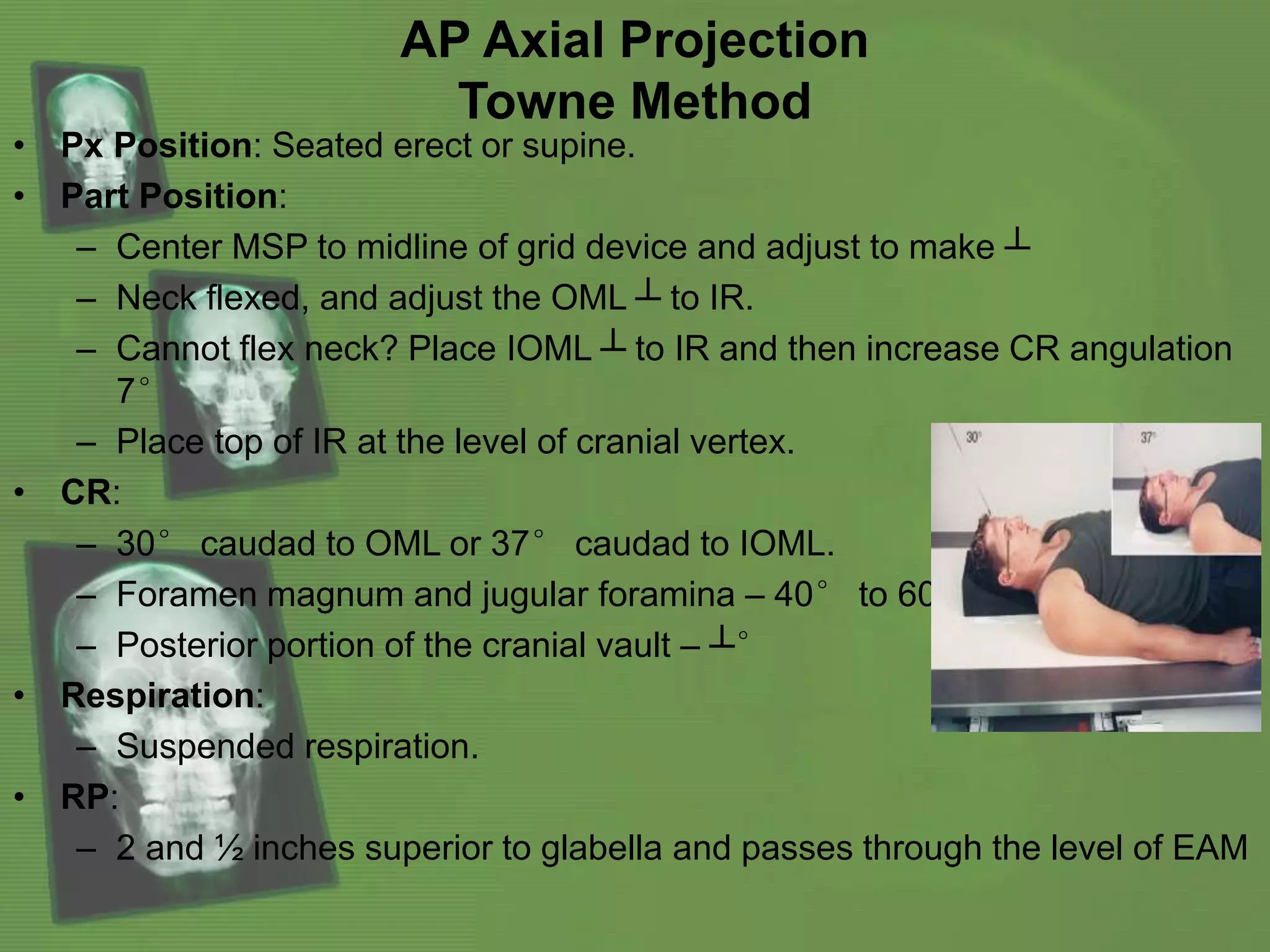 SKULL: Radiologic Positioning (Non-contrast) | PPTX