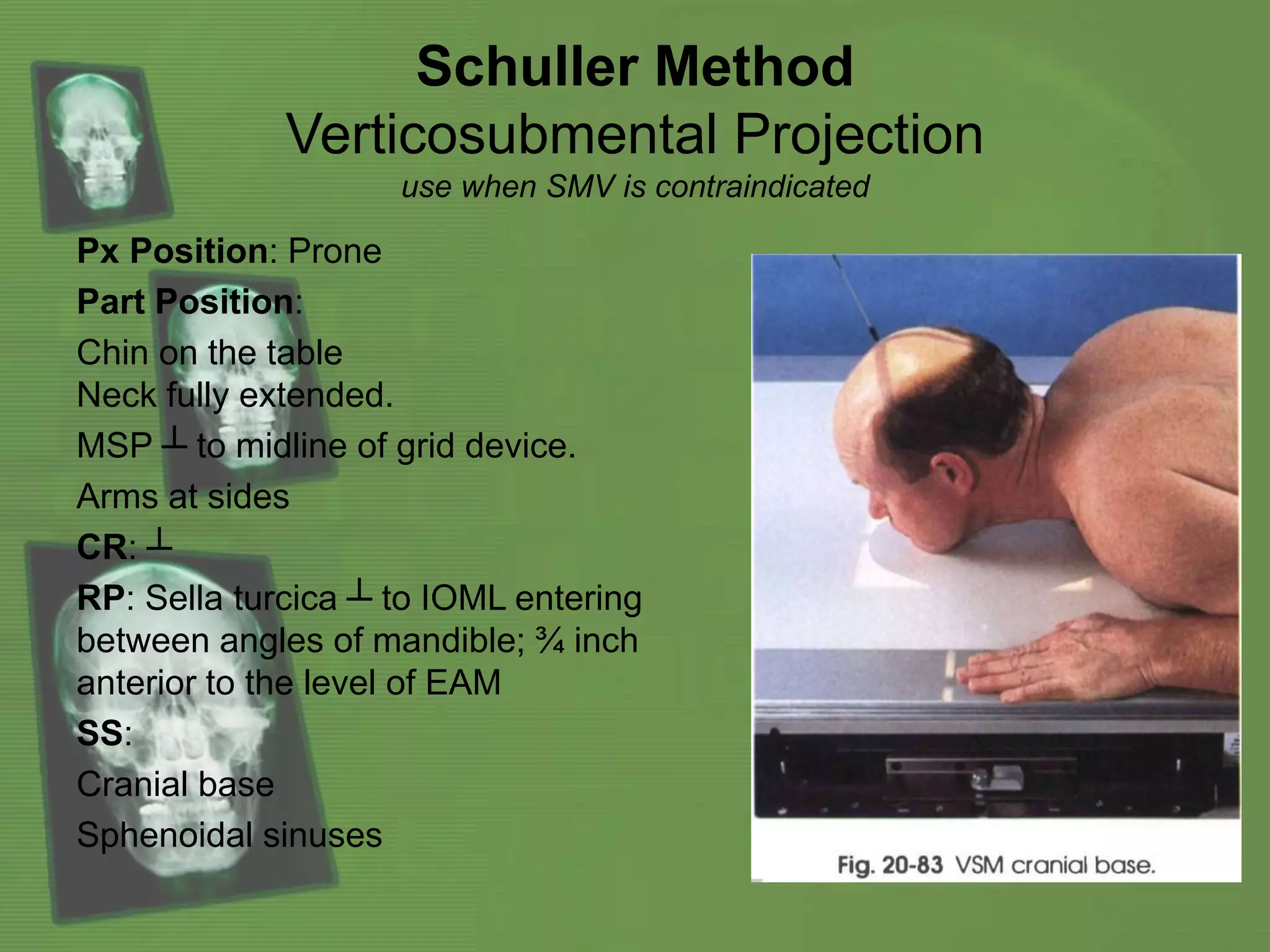SKULL: Radiologic Positioning (Non-contrast) | PPTX