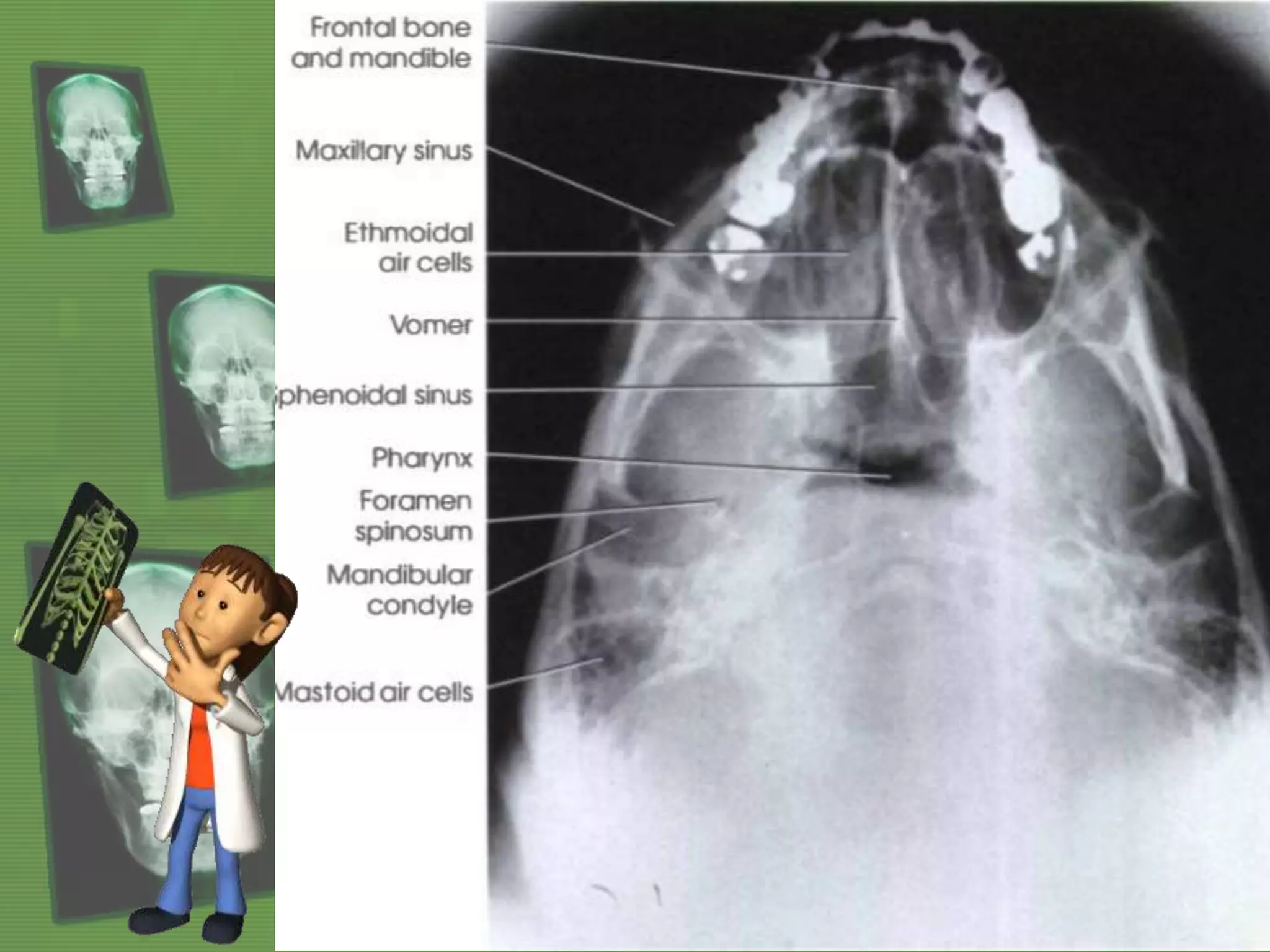 SKULL: Radiologic Positioning (Non-contrast) | PPTX