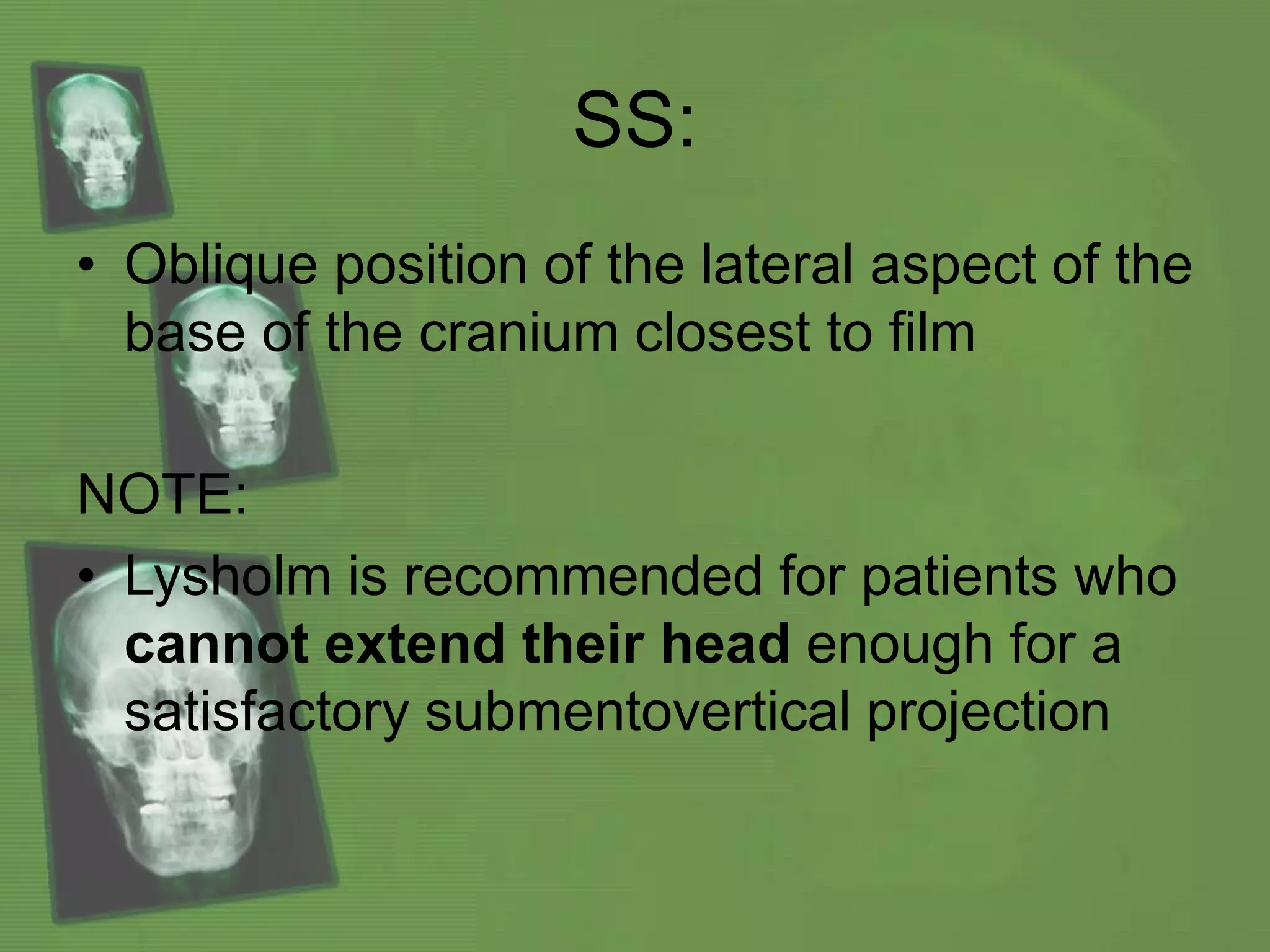 SKULL: Radiologic Positioning (Non-contrast) | PPTX