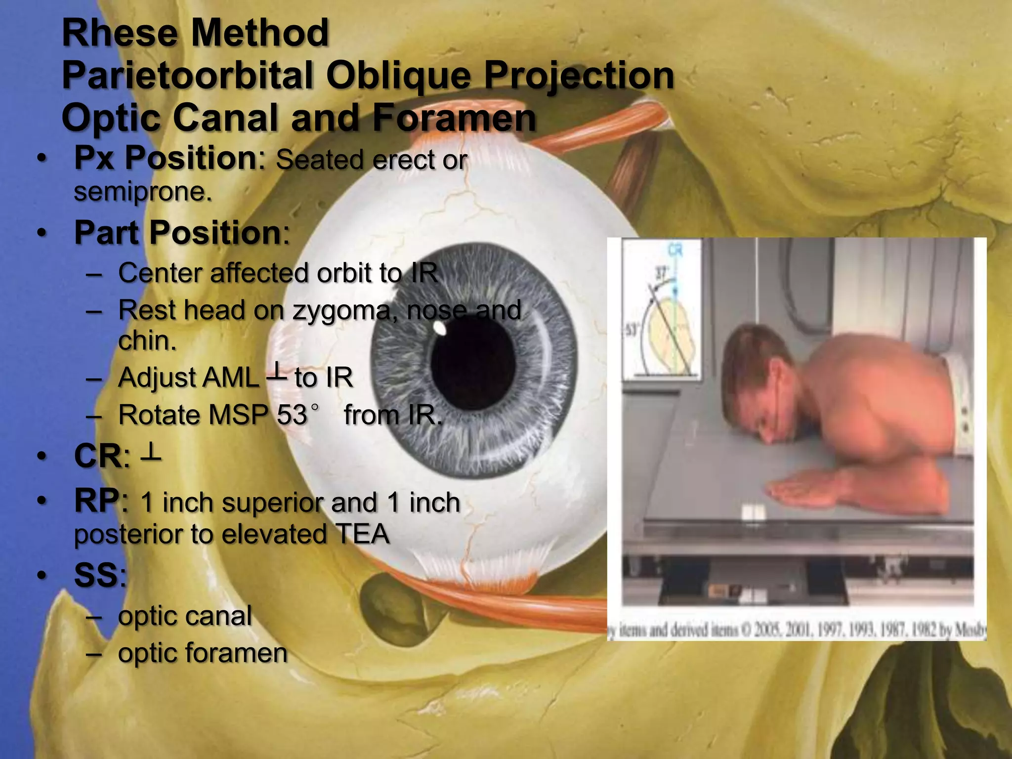 SKULL: Radiologic Positioning (Non-contrast) | PPTX