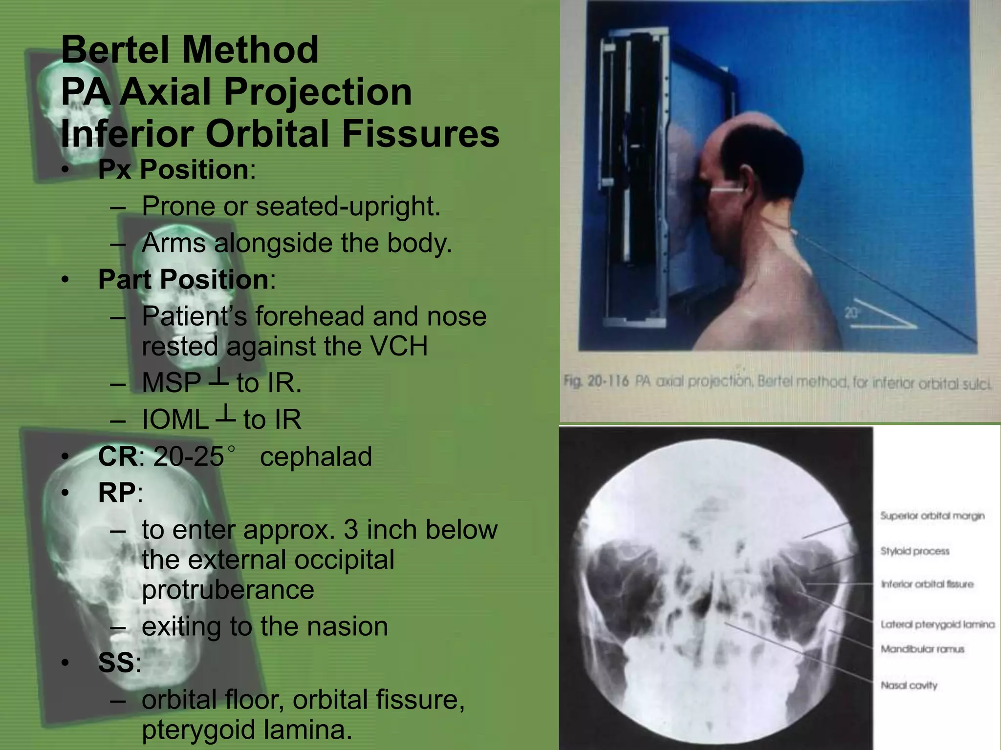 SKULL: Radiologic Positioning (Non-contrast) | PPTX