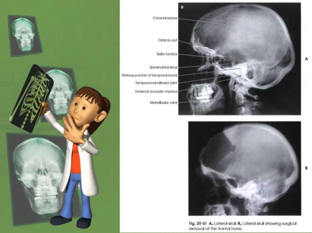 SKULL: Radiologic Positioning (Non-contrast) | PPTX