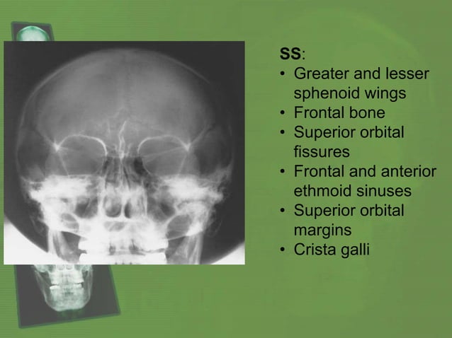 SKULL: Radiologic Positioning (Non-contrast) | PPTX