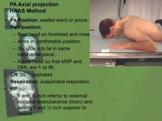 SKULL: Radiologic Positioning (Non-contrast) | PPTX