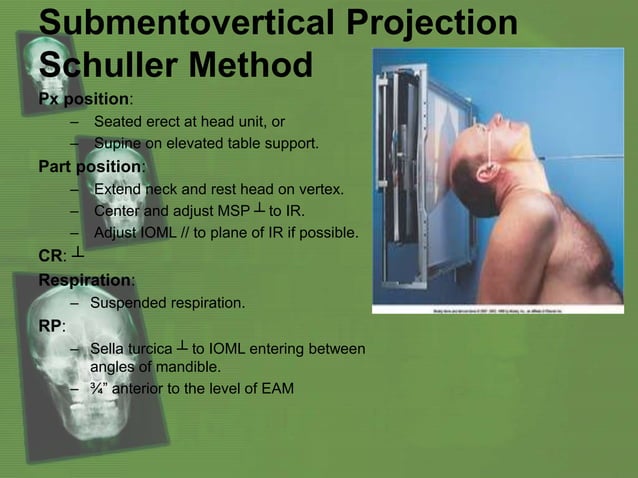 SKULL: Radiologic Positioning (Non-contrast) | PPTX