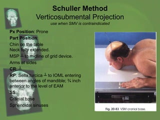 SKULL: Radiologic Positioning (Non-contrast) | PPTX
