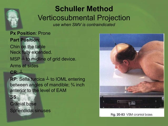 SKULL: Radiologic Positioning (Non-contrast) | PPTX