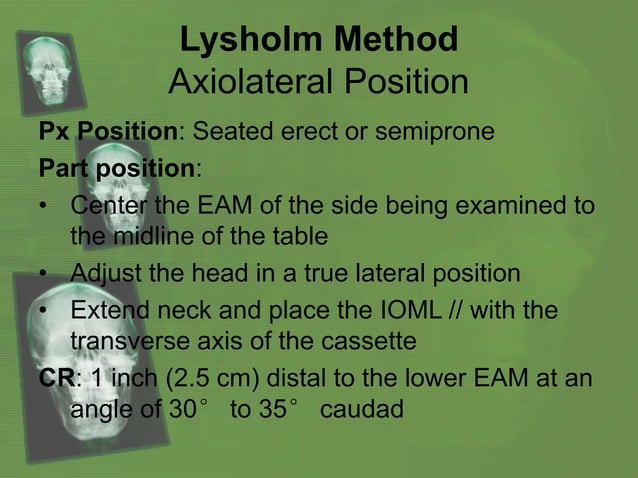 SKULL: Radiologic Positioning (Non-contrast) | PPTX