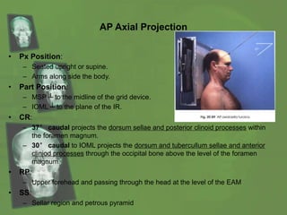 SKULL: Radiologic Positioning (Non-contrast) | PPTX