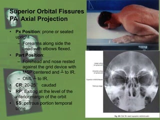 SKULL: Radiologic Positioning (Non-contrast) | PPTX