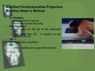 SKULL: Radiologic Positioning (Non-contrast) | PPTX