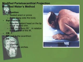 SKULL: Radiologic Positioning (Non-contrast) | PPTX