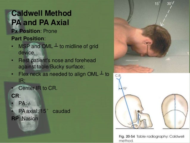 SKULL: Radiologic Positioning (Non-contrast)