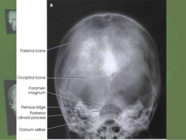 SKULL: Radiologic Positioning (Non-contrast)
