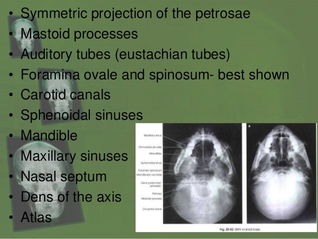SKULL: Radiologic Positioning (Non-contrast)