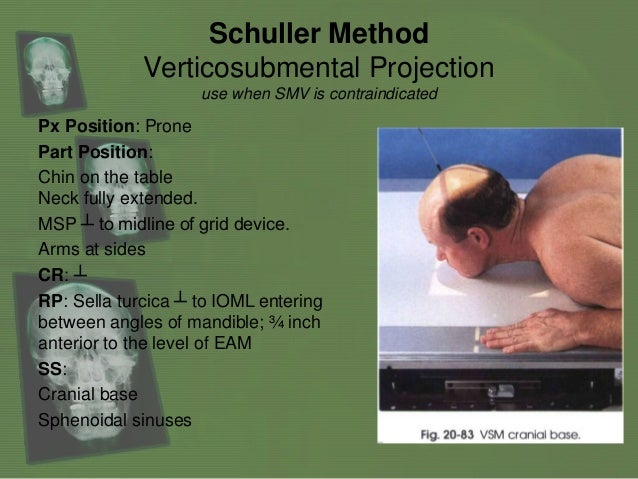 SKULL: Radiologic Positioning (Non-contrast)