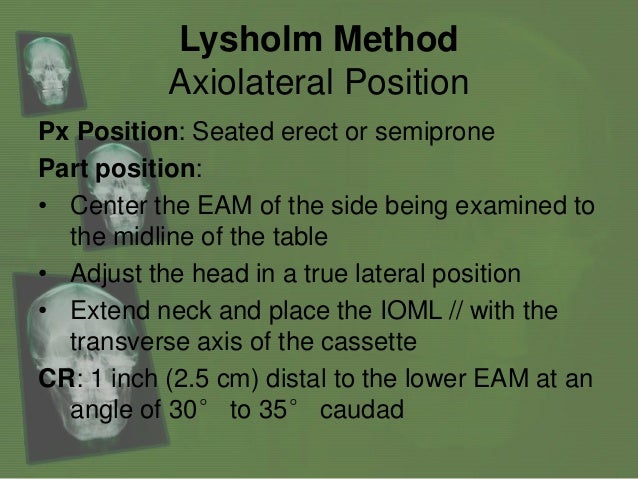 SKULL: Radiologic Positioning (Non-contrast)
