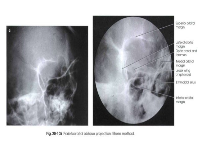 SKULL: Radiologic Positioning (Non-contrast)
