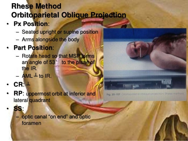 SKULL: Radiologic Positioning (Non-contrast)