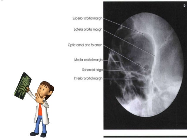 SKULL: Radiologic Positioning (Non-contrast)