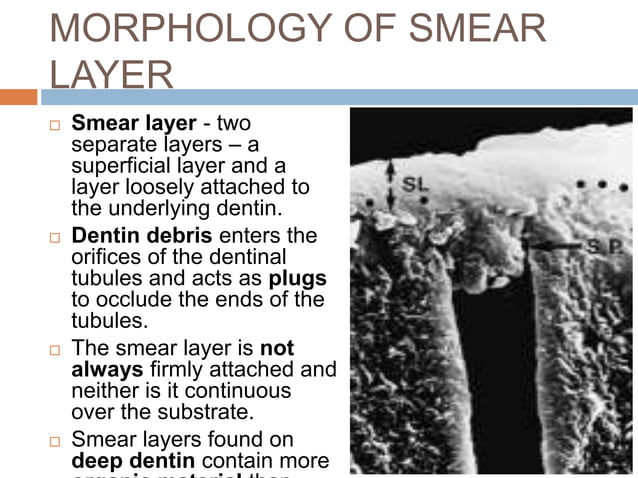 The Smear Layer | PPTX | Dental Health | Diseases and Conditions