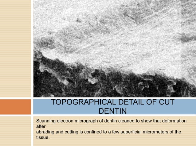 The Smear Layer | PPTX | Dental Health | Diseases and Conditions