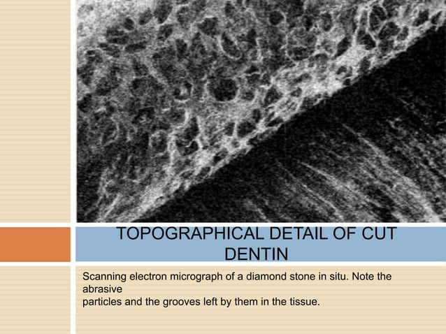 The Smear Layer | PPTX | Dental Health | Diseases and Conditions