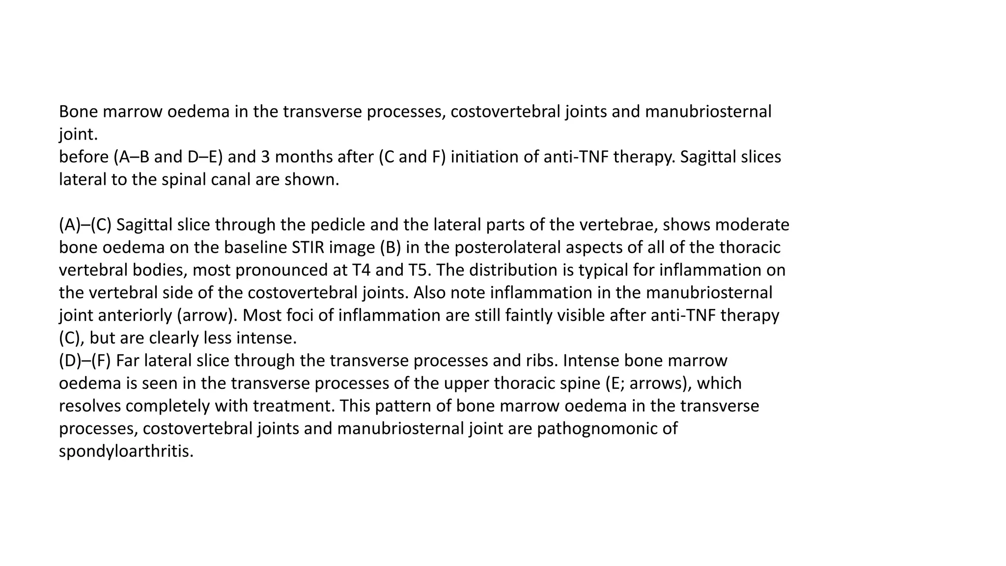 THE SPINE IN THE COURSE OF SPONDYLOARTHROPATHIES.pptx