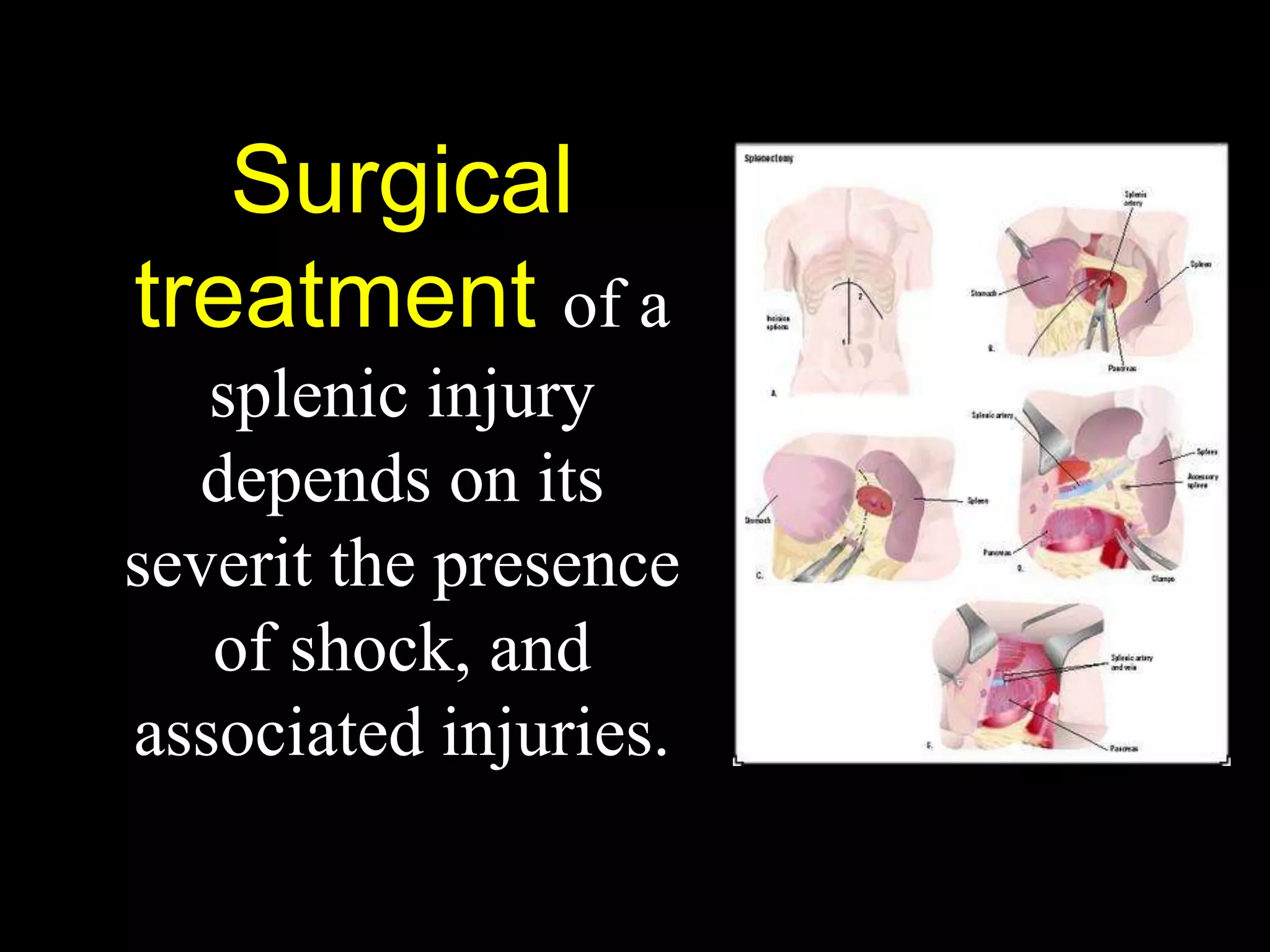 The spleen in surgery in general | PPTX