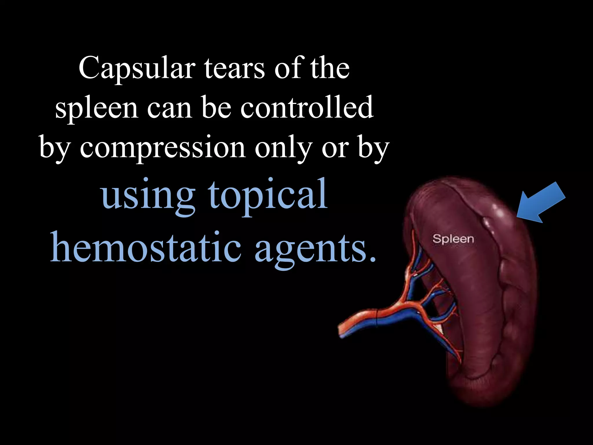 The spleen in surgery in general | PPTX