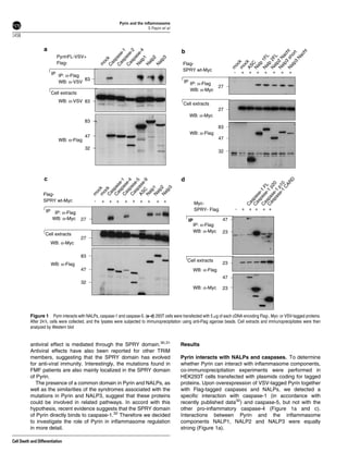 The SPRY domain of pyrin, mutated in familial mediterranean fever | PDF