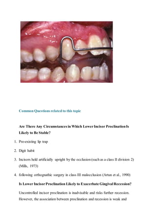 The stability of class ii malocclusion for orthodontists by Almuzian | DOCX