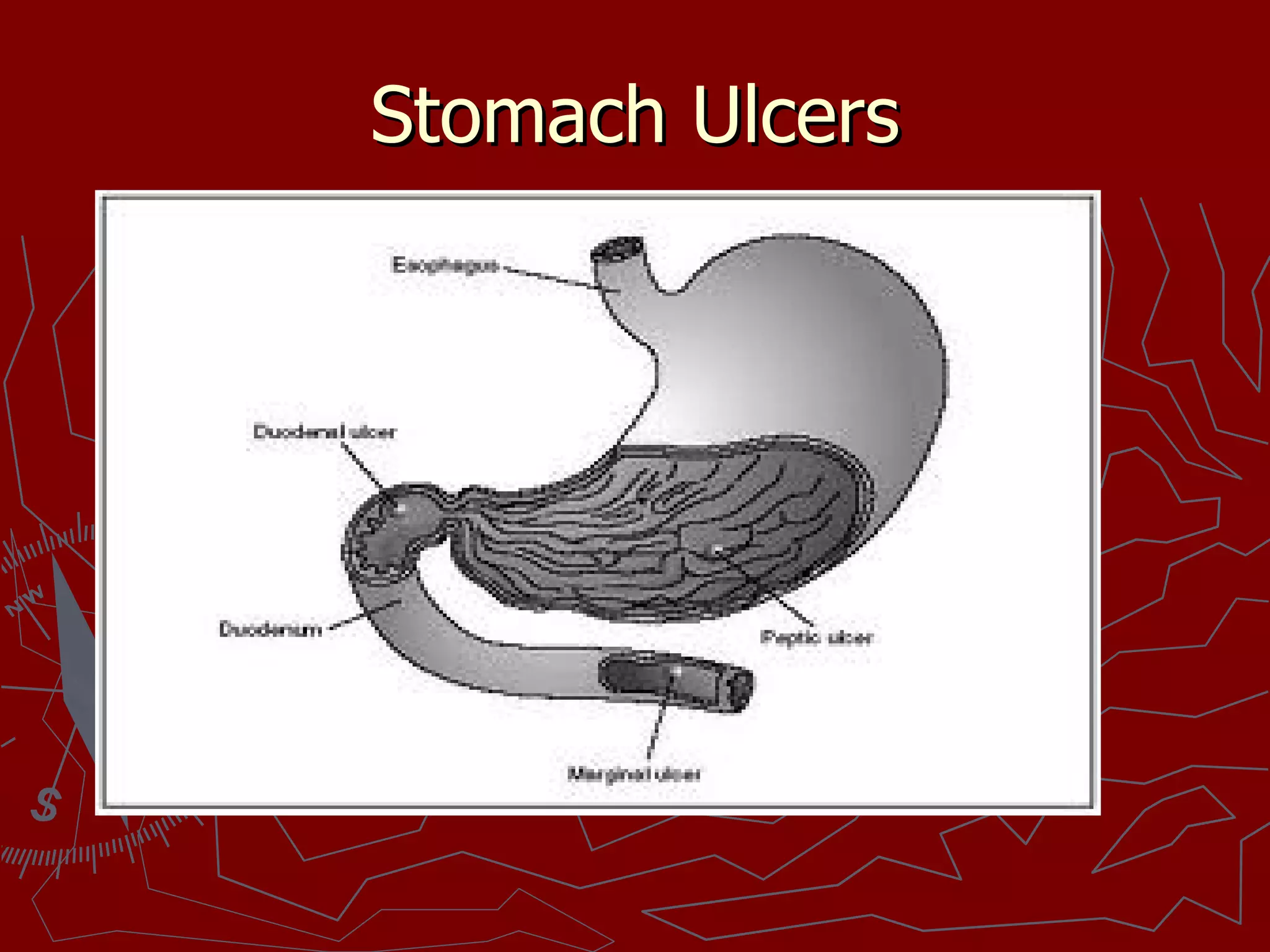 The stomach presentation | PPT
