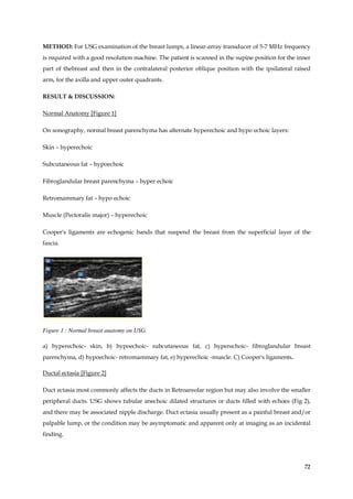 The study of different presentations of breast lumps in radiographic ...