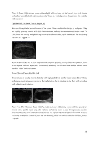 The study of different presentations of breast lumps in radiographic ...