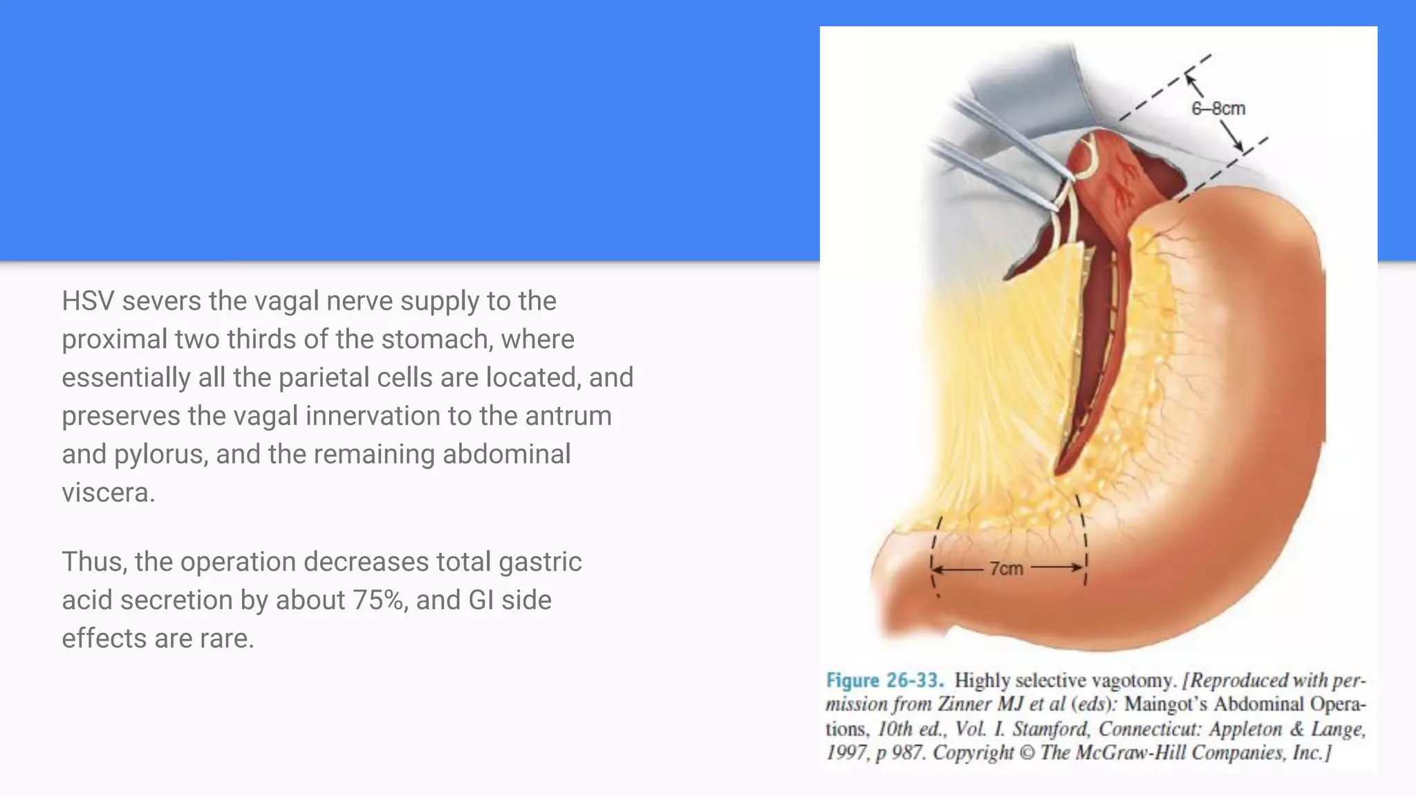 The surgical management of the gastric ulcers and the tumors of the ...