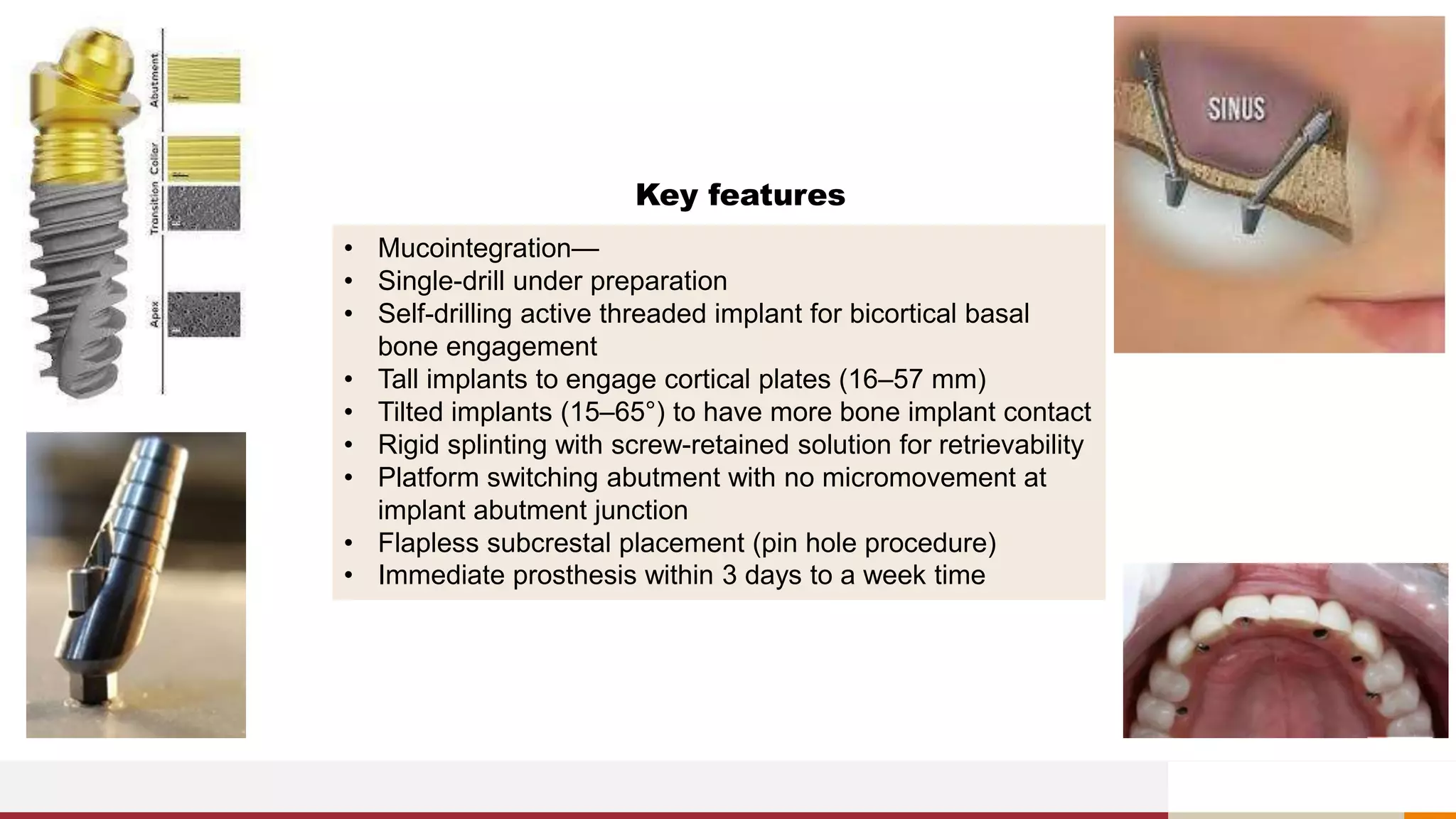 The Tall Tilted Pin Hole Placement Immediate Loading.pptx