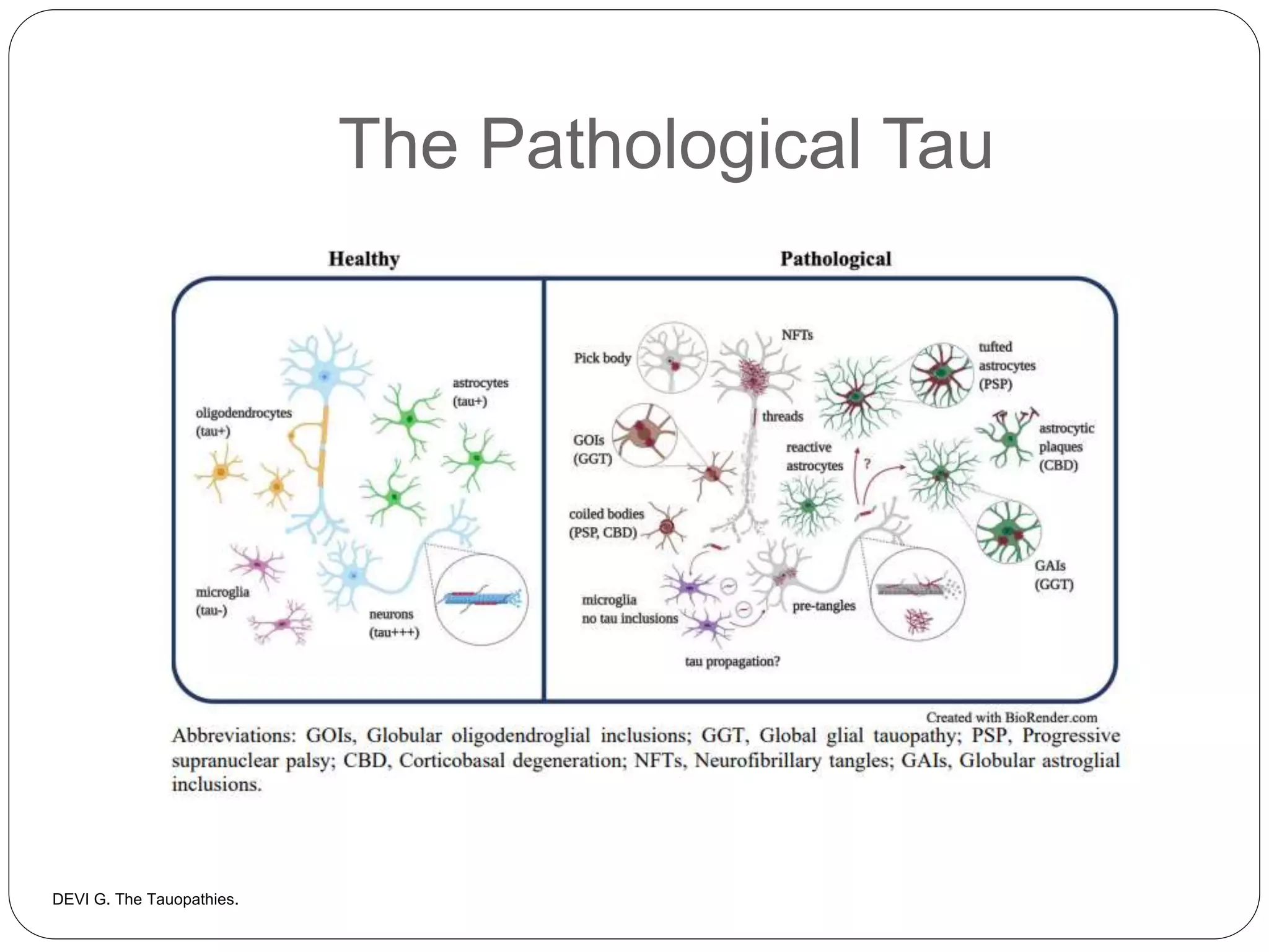 The Tauopathies.pptx