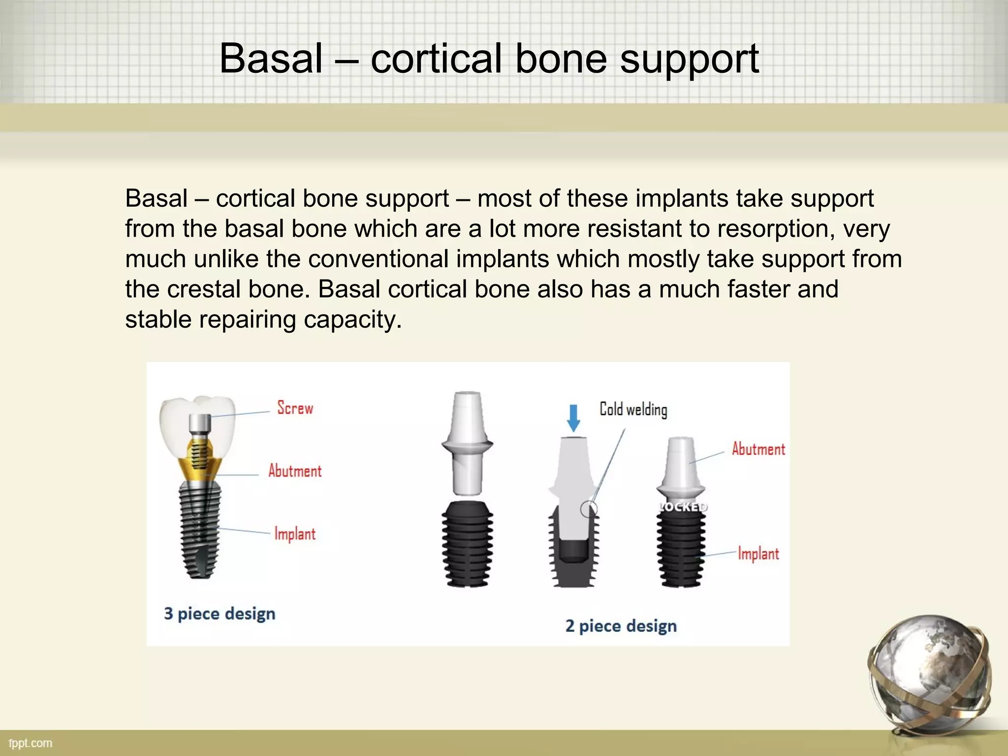 The techniques of basal implants | PPT