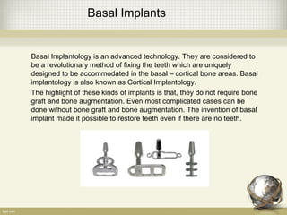 The techniques of basal implants | PPT