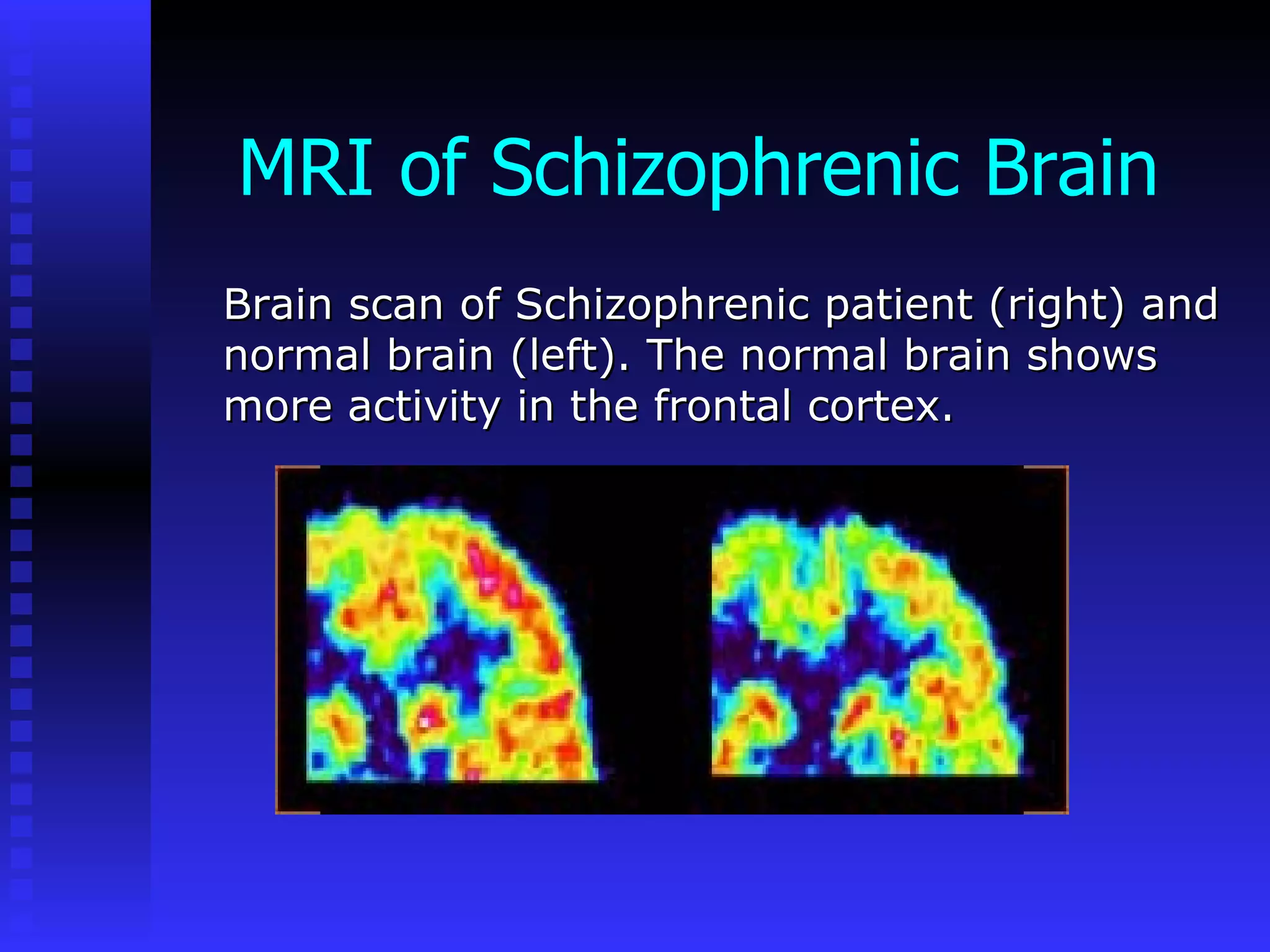The Teenage Brain | PPT