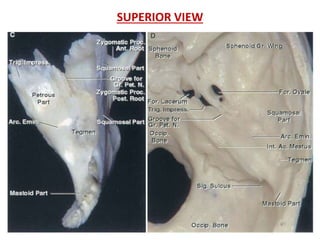 The temporal bone and transtemporal approaches