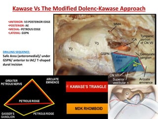 The temporal bone and transtemporal approaches | PPT