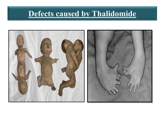 The Thalidomide tragedy.pptx | Pregnancy | Reproductive Health