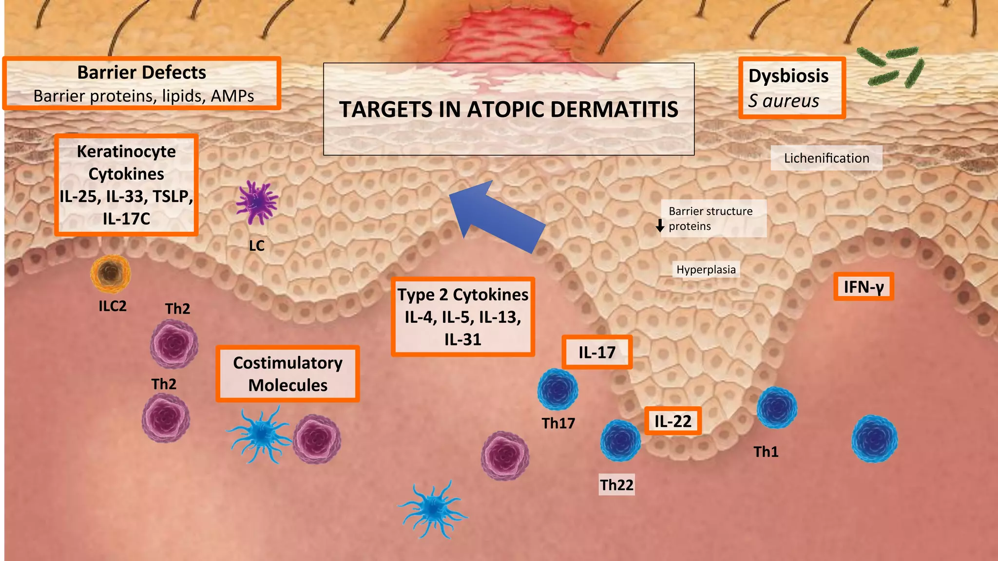 The therapeutic landscape in atopic dermatitis | PDF