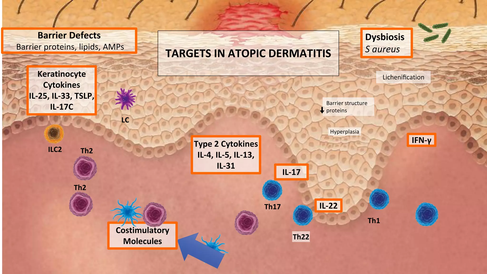 The therapeutic landscape in atopic dermatitis | PDF