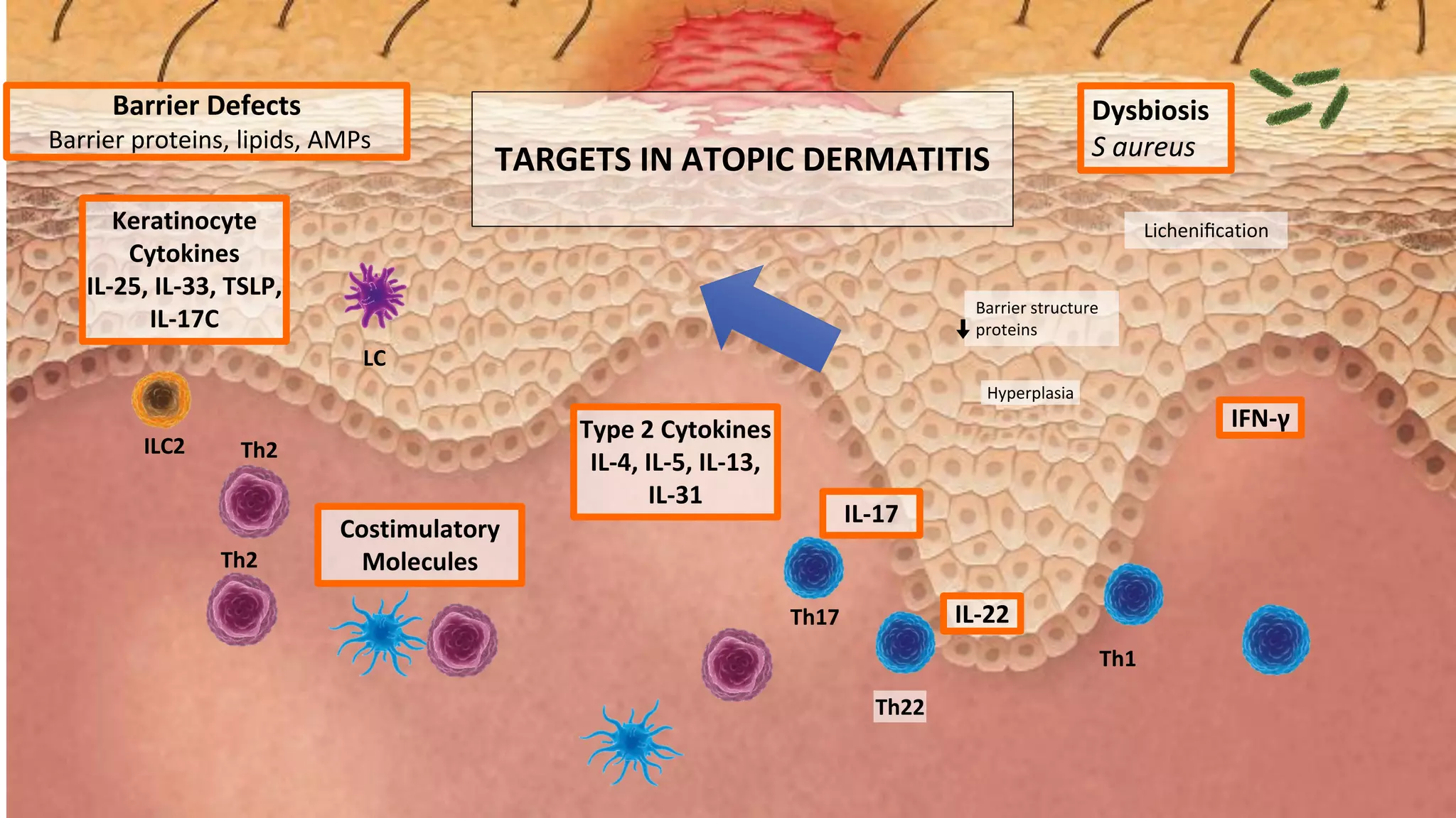The therapeutic landscape in atopic dermatitis | PDF